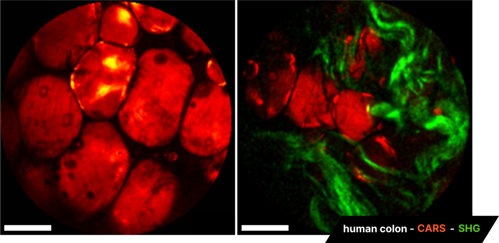 Cell Imaging Lightcore Technologies