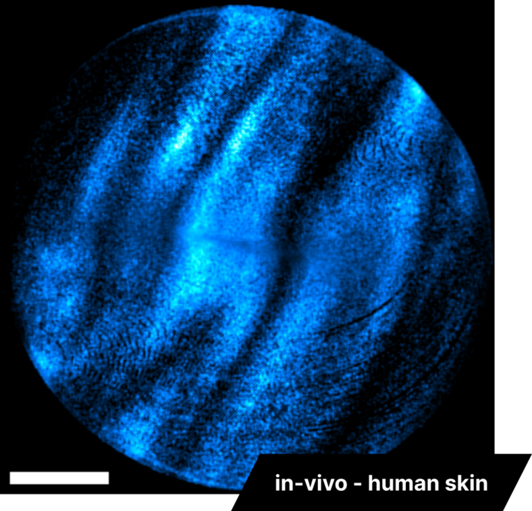 Skin imaging - Lightcore Technologies