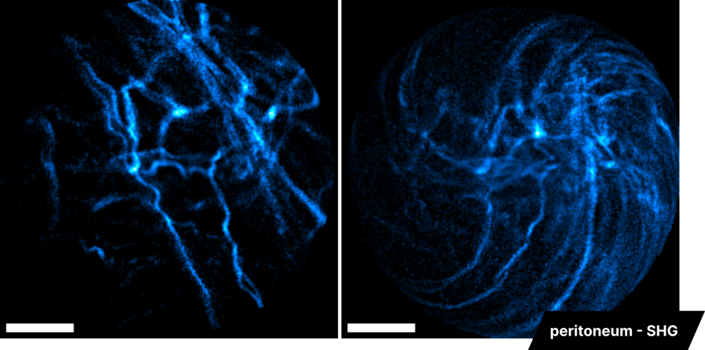 Protein imaging - Lightcore Technologies
