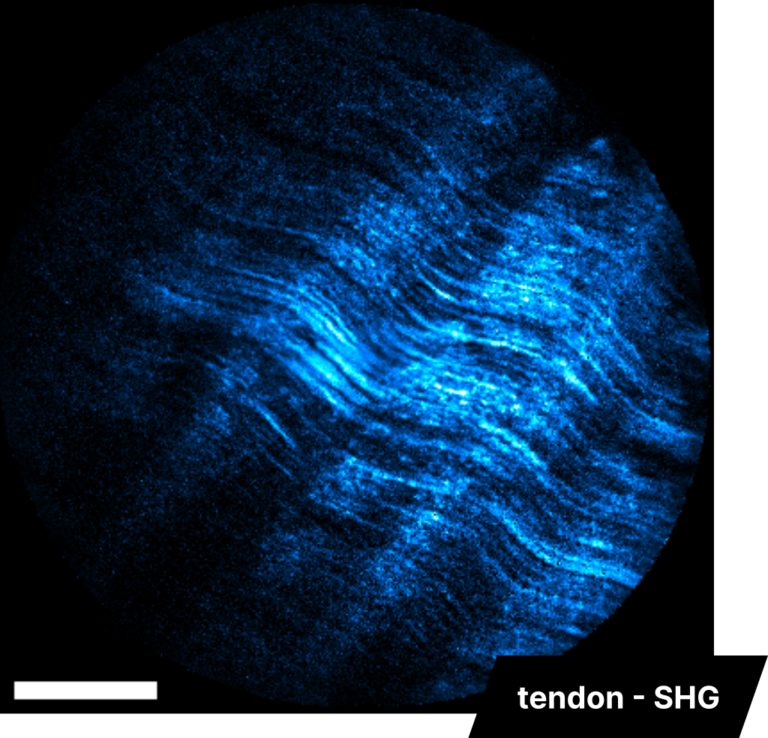 Protein imaging - Lightcore Technologies